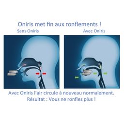 Oniris Orthèse Anti-Ronflement 1 pc(s) - Farmaline