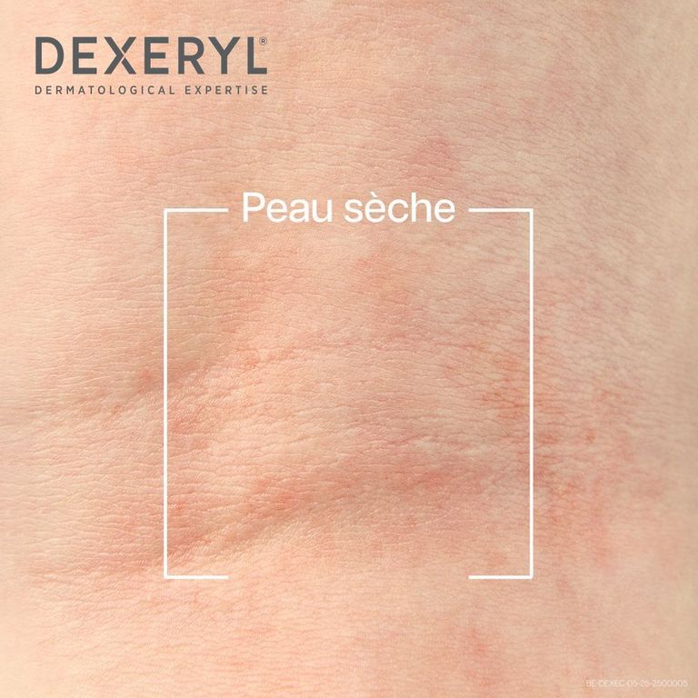 Dexeryl Crème Emolliente | Traitement Peaux Sèches Atopiques Visage Et ...
